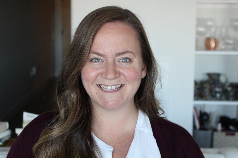 Everything you need to know about Botox | My Experience + Botox Facts